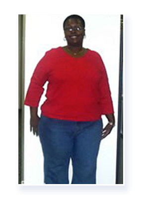 Bariatric Surgery & Weight Loss Procedures - Obesity Understood JSAPA